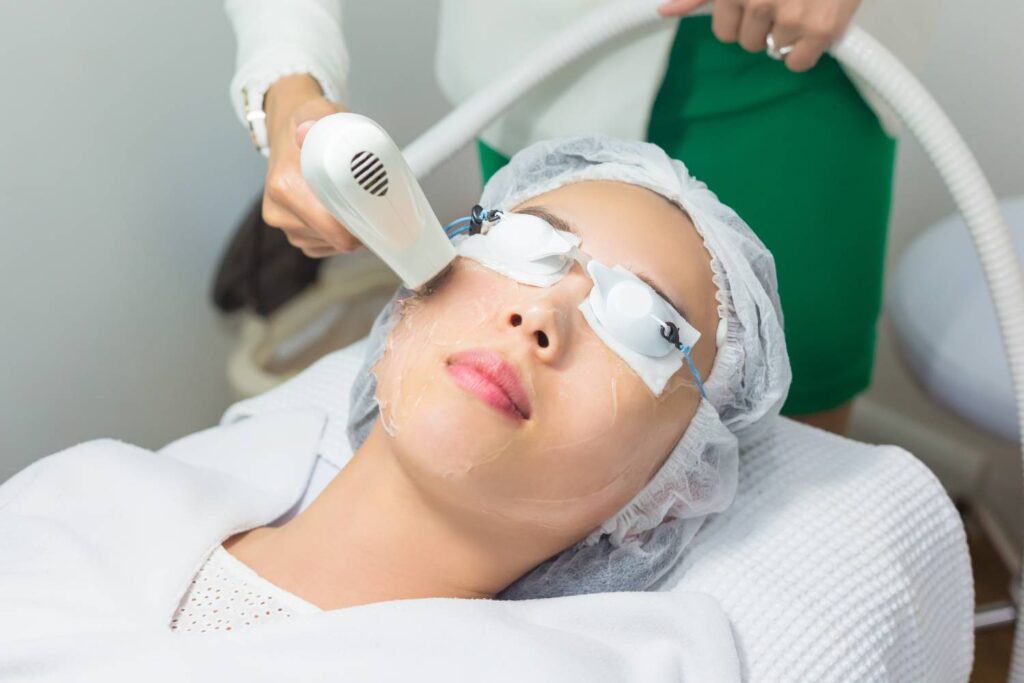 How IPL Photofacials Can Rejuvenate Your Skin and Fight Ageing ...